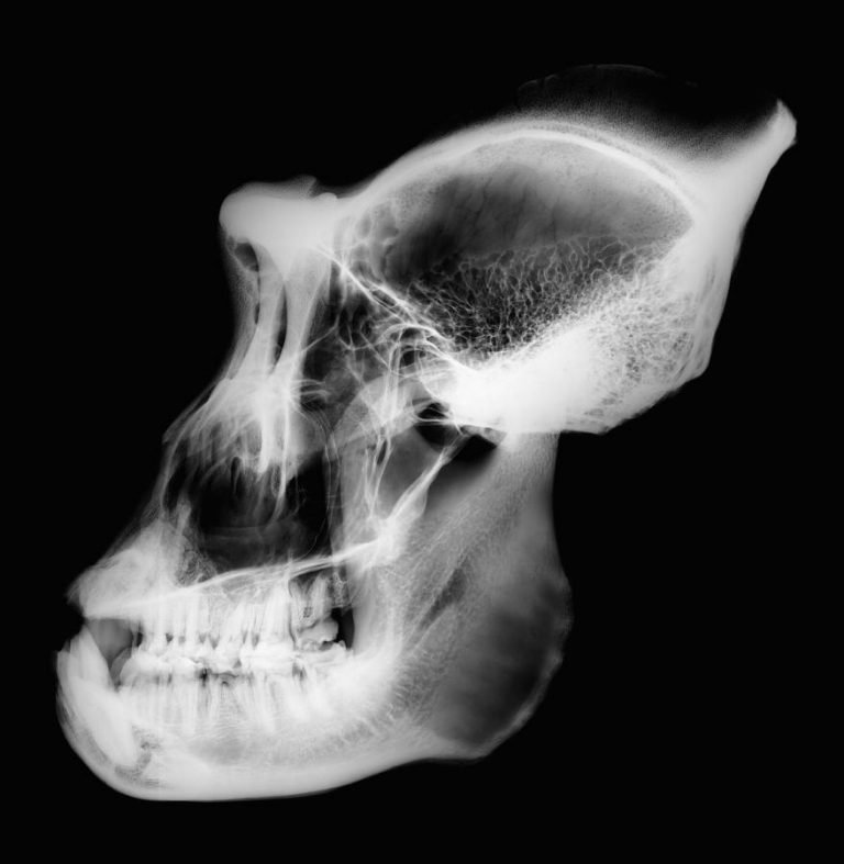 GORILLA SKULL | Buyxraysonline