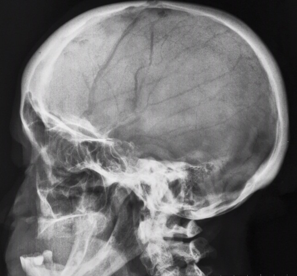 NORMAL FETAL SKULL 28 WEEKS Buyxraysonline NORMAL FETAL SKULL 28 WEEKS Buyxraysonline